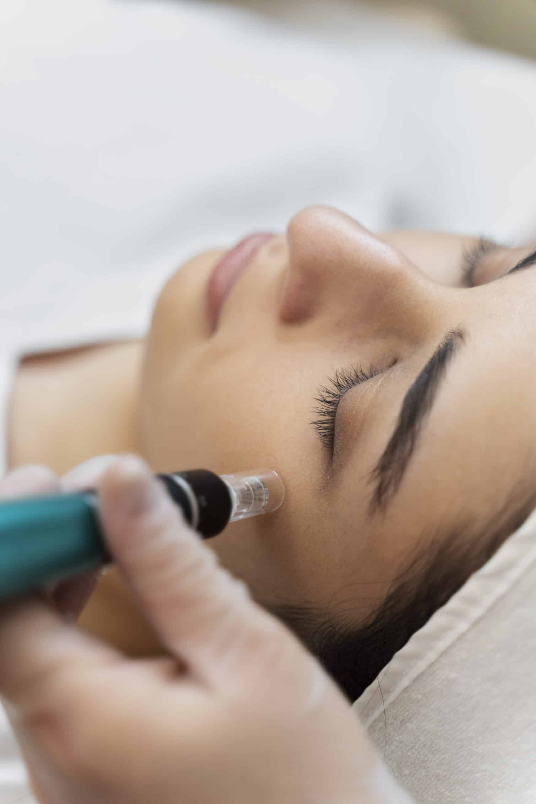 Micro Infusion Facial - SIFVEINFINDER